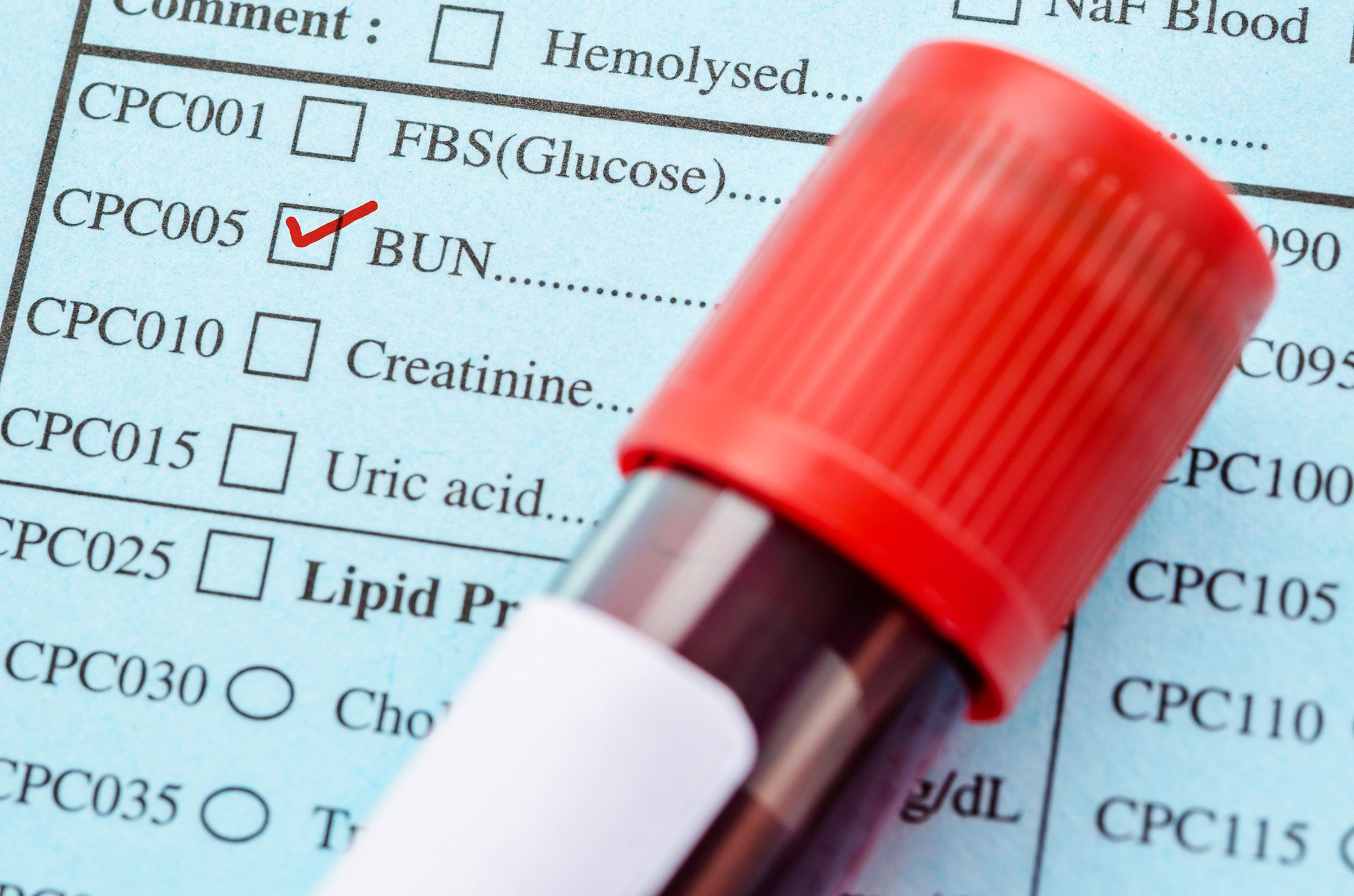 Bloodwork + Routine Lab Tests in Denver, CO - YAO Clinic